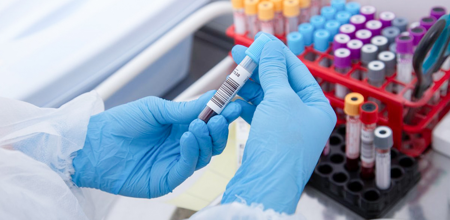 Stunning appearance! BIOBASE new product: Blood Coagulation Analyzer BK ...